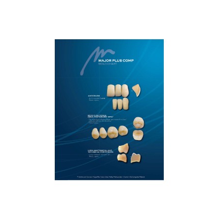Major Plus Comp Mold Chart - Hard Copy